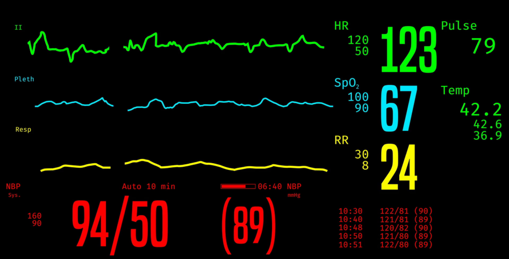 Vital Signs Everything Explained Clearly Made For Medical